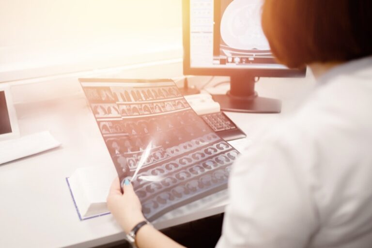 When To Worry About MRI Results? | One Step Diagnostic