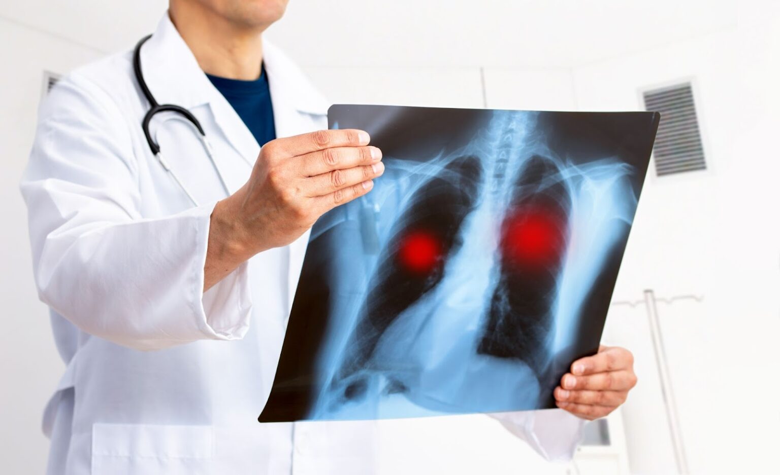 CT Scans For Lung Cancer Detection | One Step Diagnostic